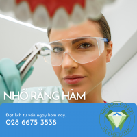 CÓ NÊN NHỔ RĂNG HÀM KHÔNG? VÀ NHỮNG ĐIỀU BẠN CẦN PHẢI LƯU Ý KHI QUYẾT ...